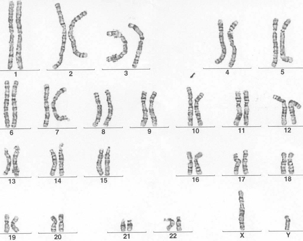 Neue Ära der Genforschung: Forscher rekonstruieren vollständigen Gencode eines menschlichen ...