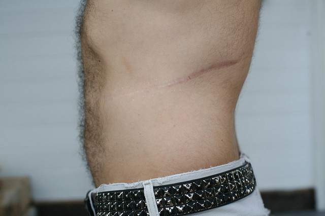 Schlechte Nachrichten für Schönheitschirurgen: Wissenschaftler forschen ...